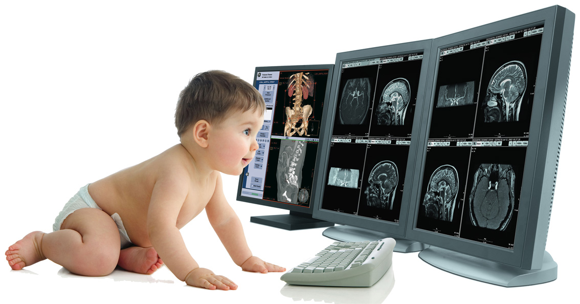 Centricity Solutions take South Denmark's Radiology departments to a ...