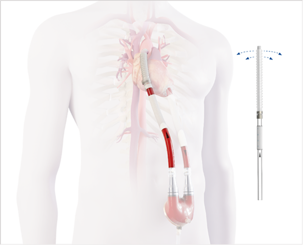 Berlin Heart Received CE Mark and Announces First Implantation of the ...