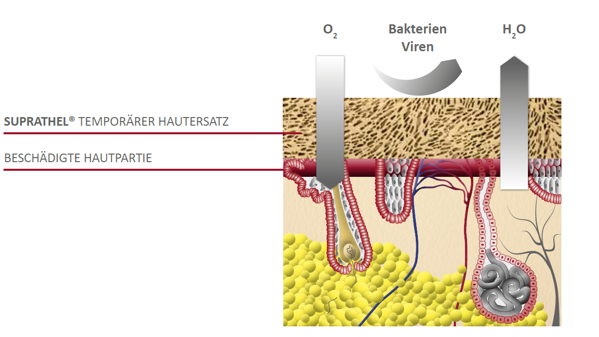 Innovative Ansätze senken Behandlungskosten, BIOPRO Baden-Württemberg ...