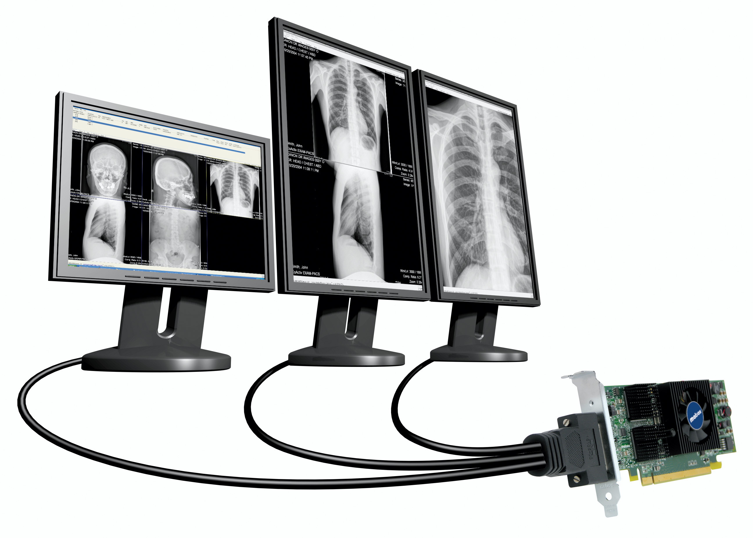 NEU: "Matrox AURORA VX Serie" - Beispielhafte Vielseitigkeit für das ...