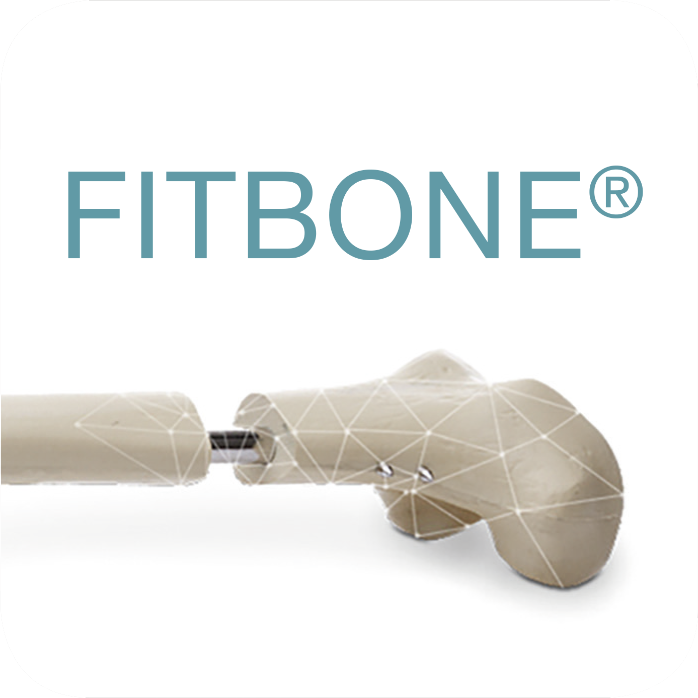 FITBONE® smartphone app lets patients actively accompany their ...