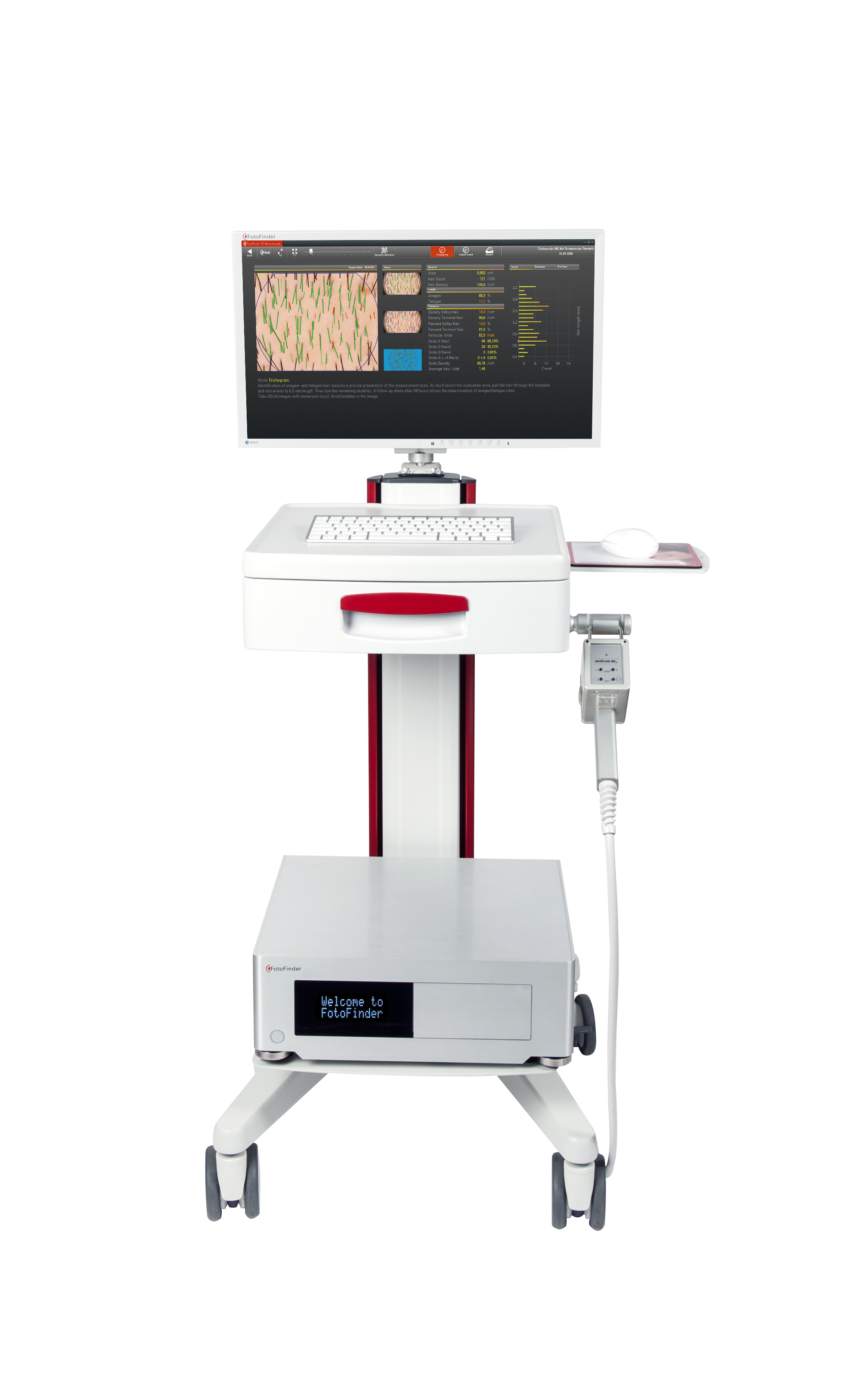 Digitale Haaranalyse: FotoFinder Trichoscale setzt neue Akzente ...