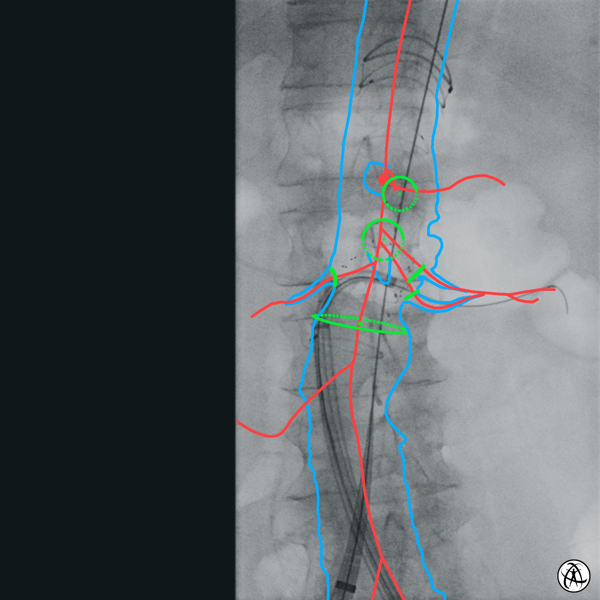 ECR 2025: Ziehm Imaging presents new solution for intraoperative ...