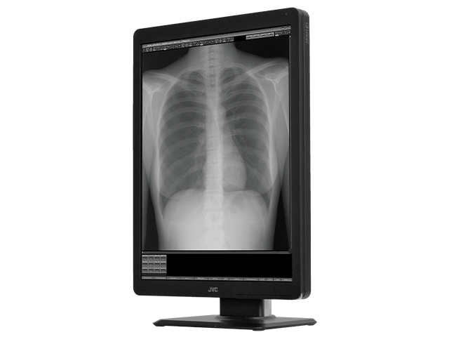 Display für die Röntgen- und Mammografiediagnostik, JVCKENWOOD ...