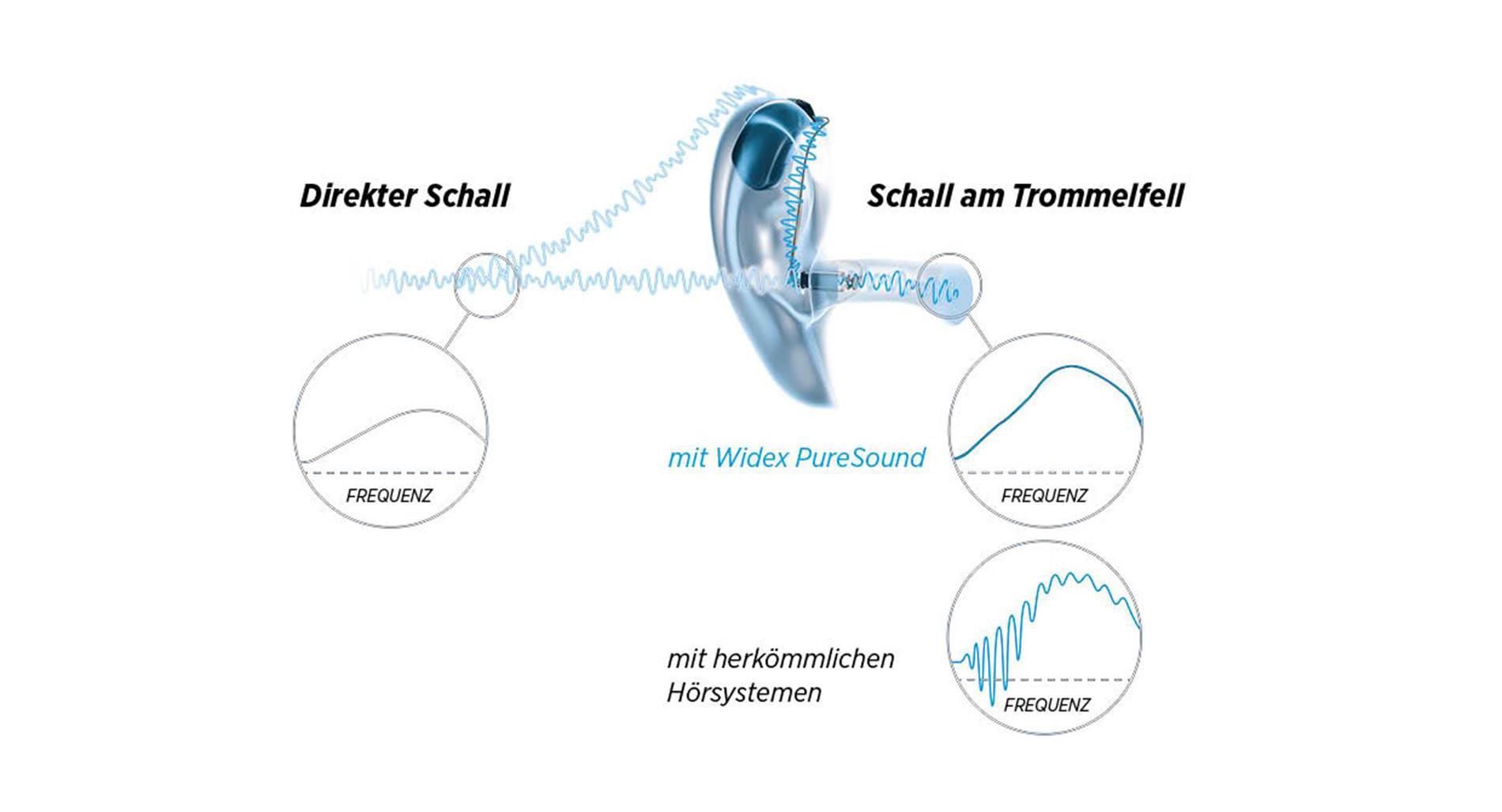 Optimale Klangqualität durch Ultraschnelle Signalverarbeitung: Die neue ...