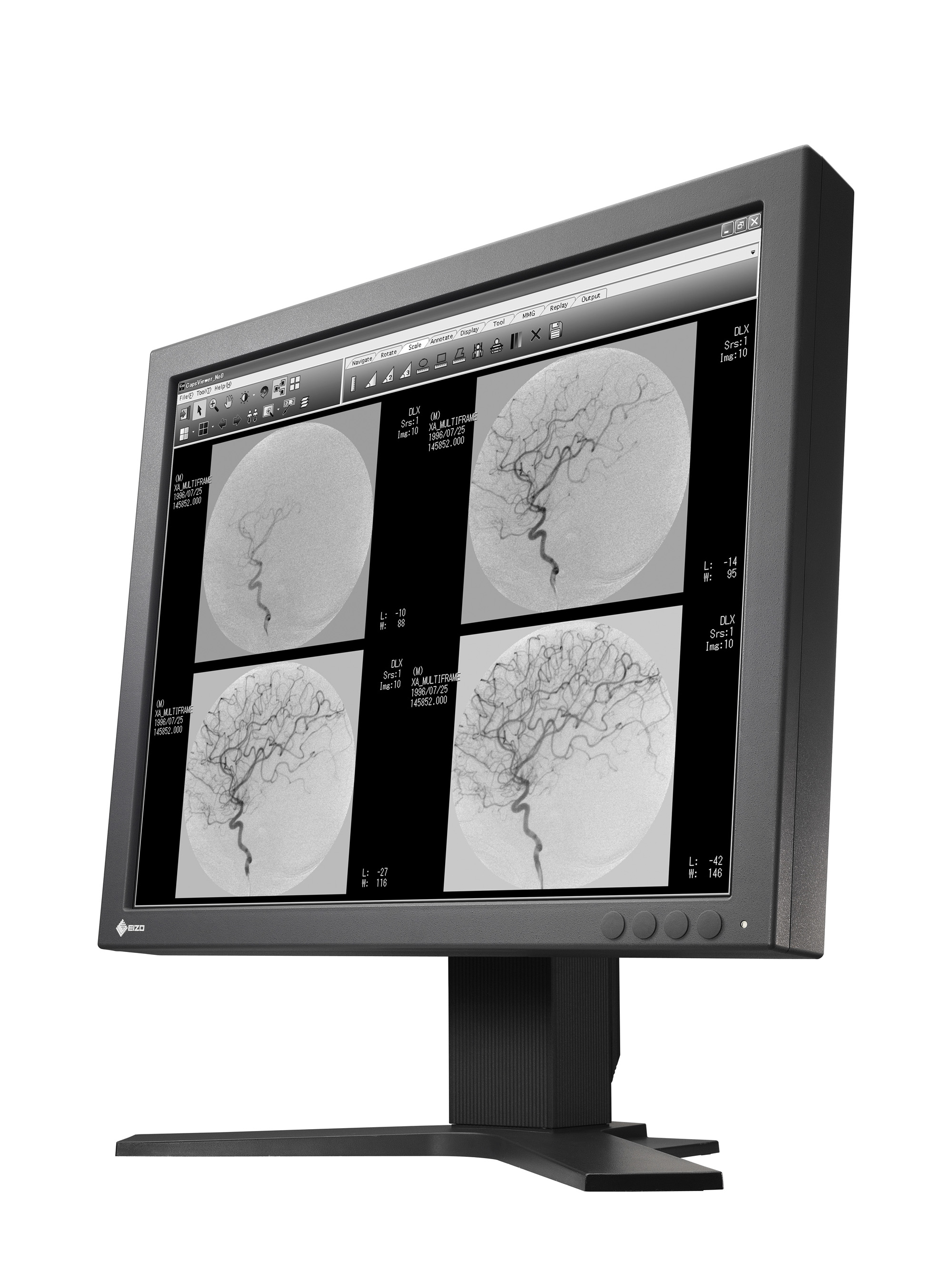 EIZO SMD 19102 DL Monitor Reduces Radiation Exposure from Legacy ...