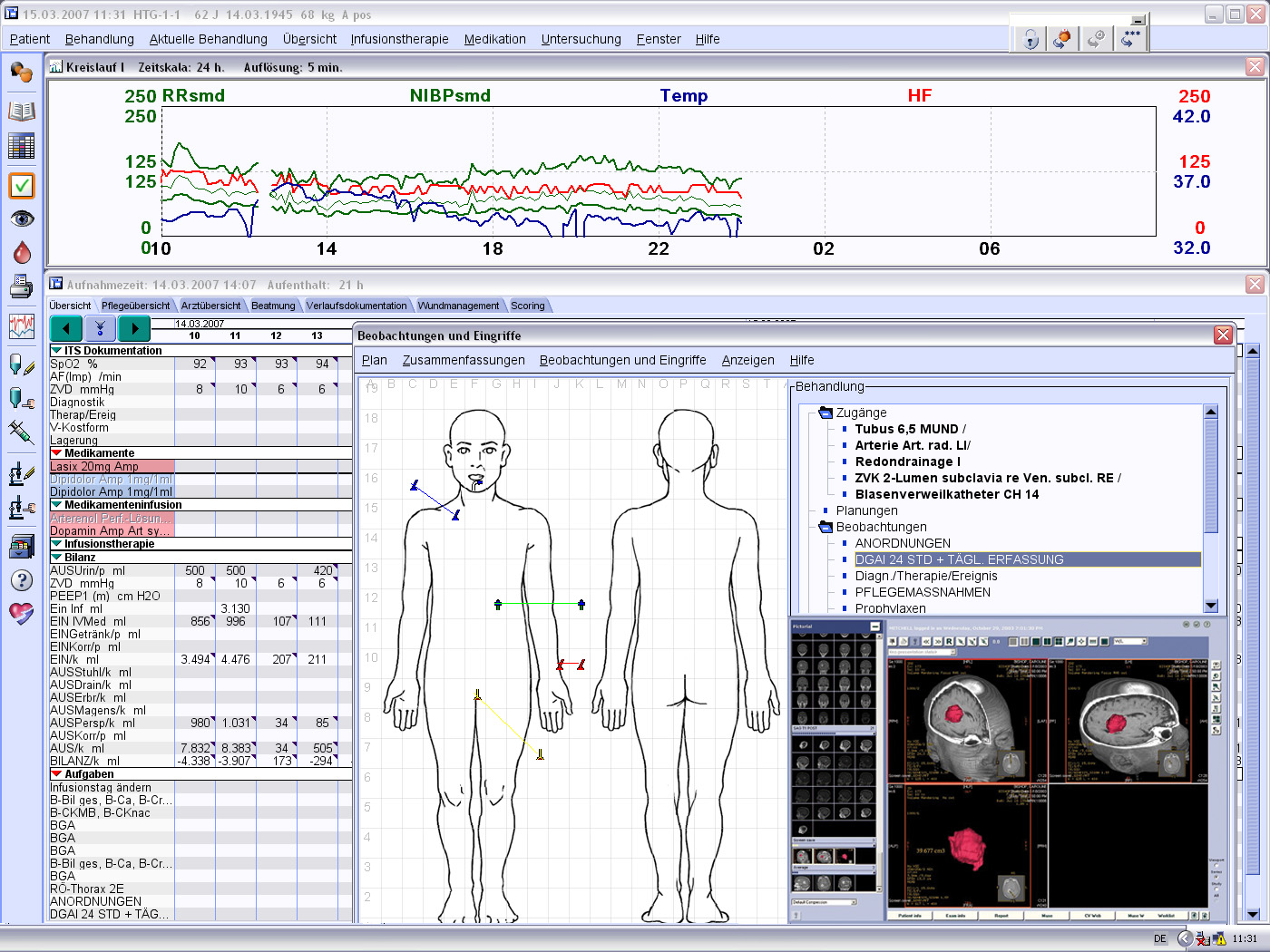 Alles unter Kontrolle - Mit dem GE Healthcare Patienten Daten ...