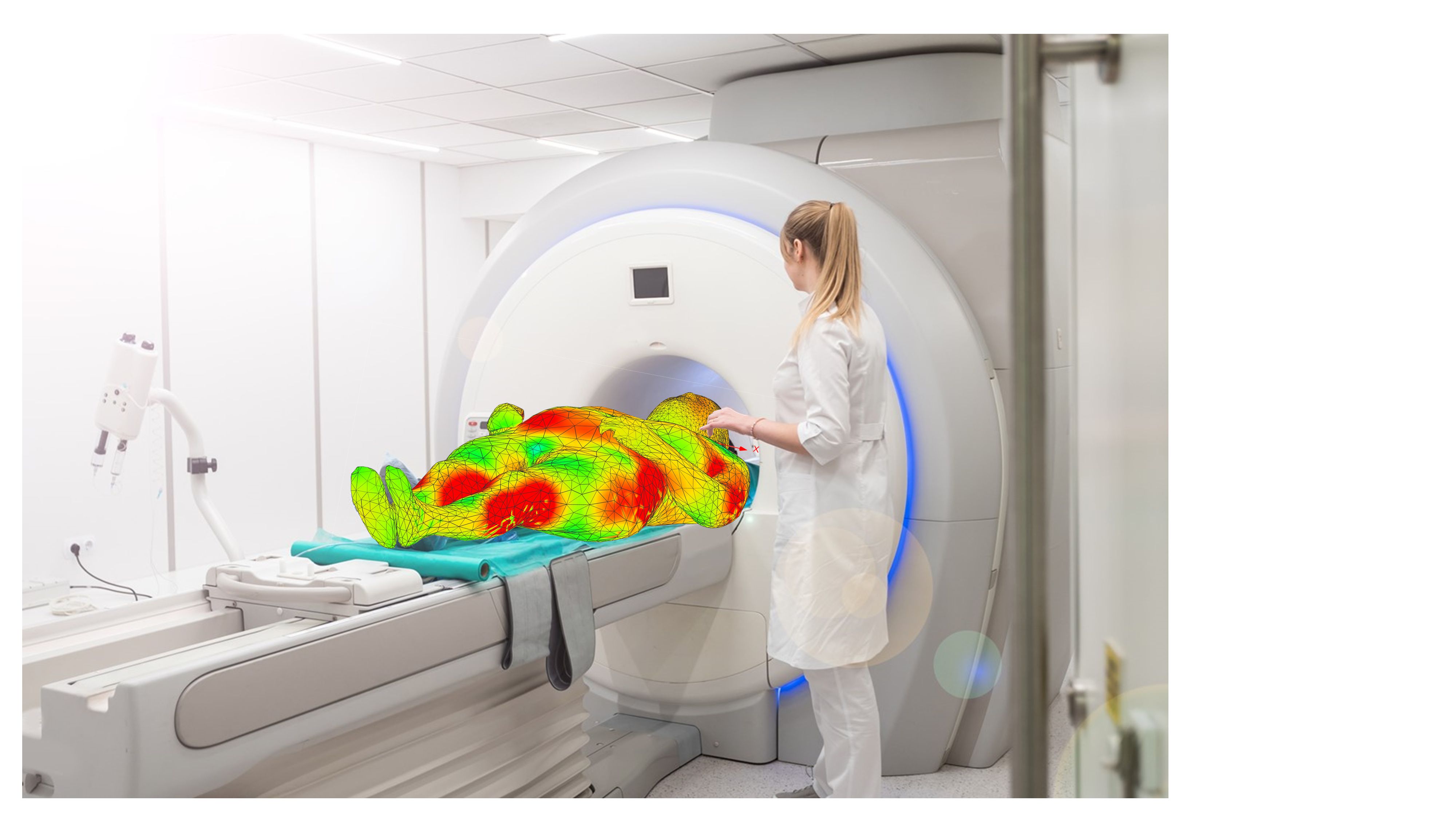 MRT trotz Implantat – Simulation schützt vor Hitzeschäden, CADFEM ...