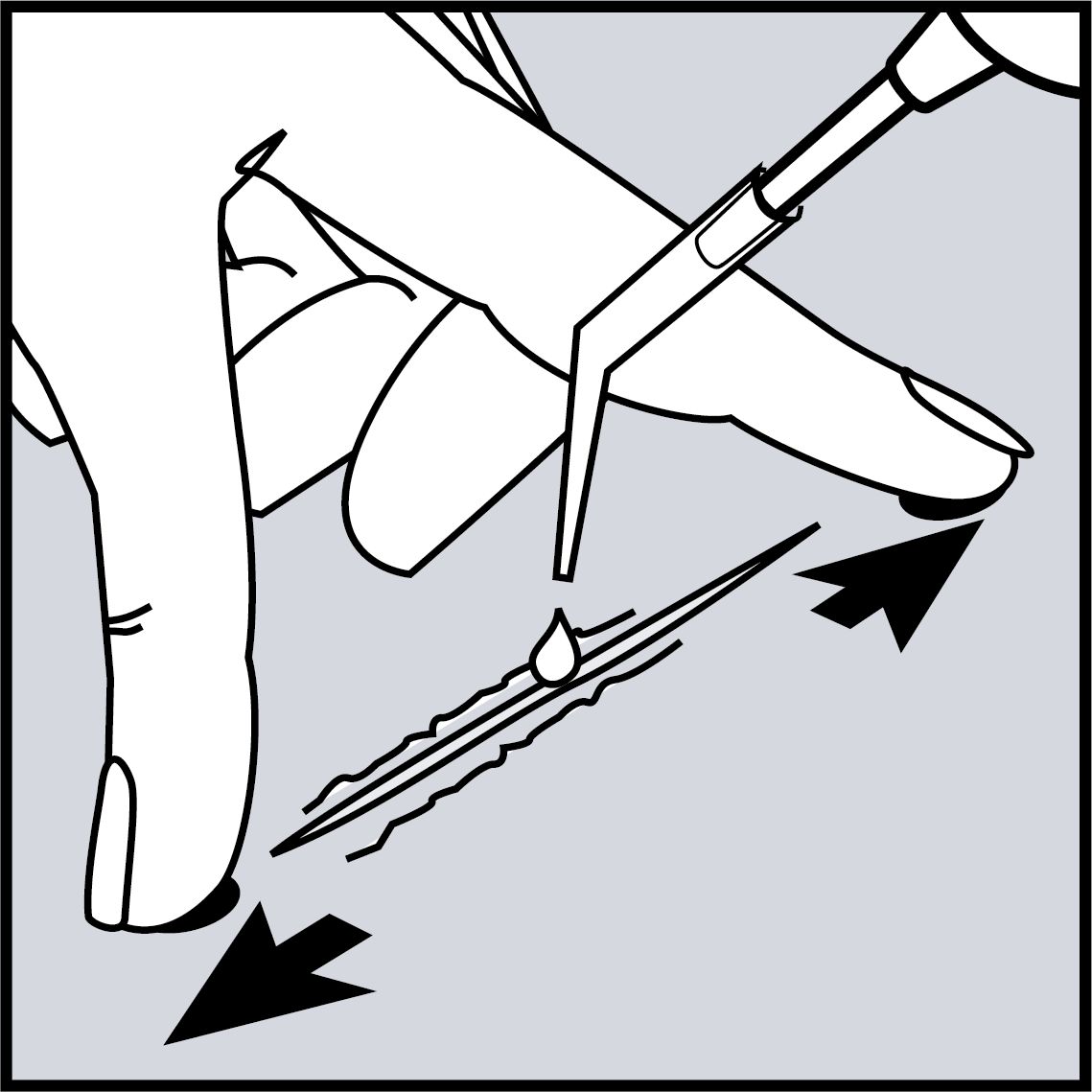 Wundkleber: Die beste Erfindung seit es Nadel und Faden gibt / Modernes ...