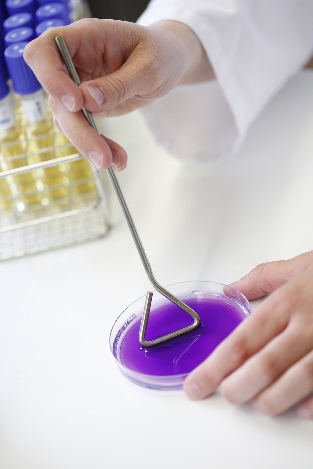 Quick detection method for germs developed for laundries, Hohenstein ...