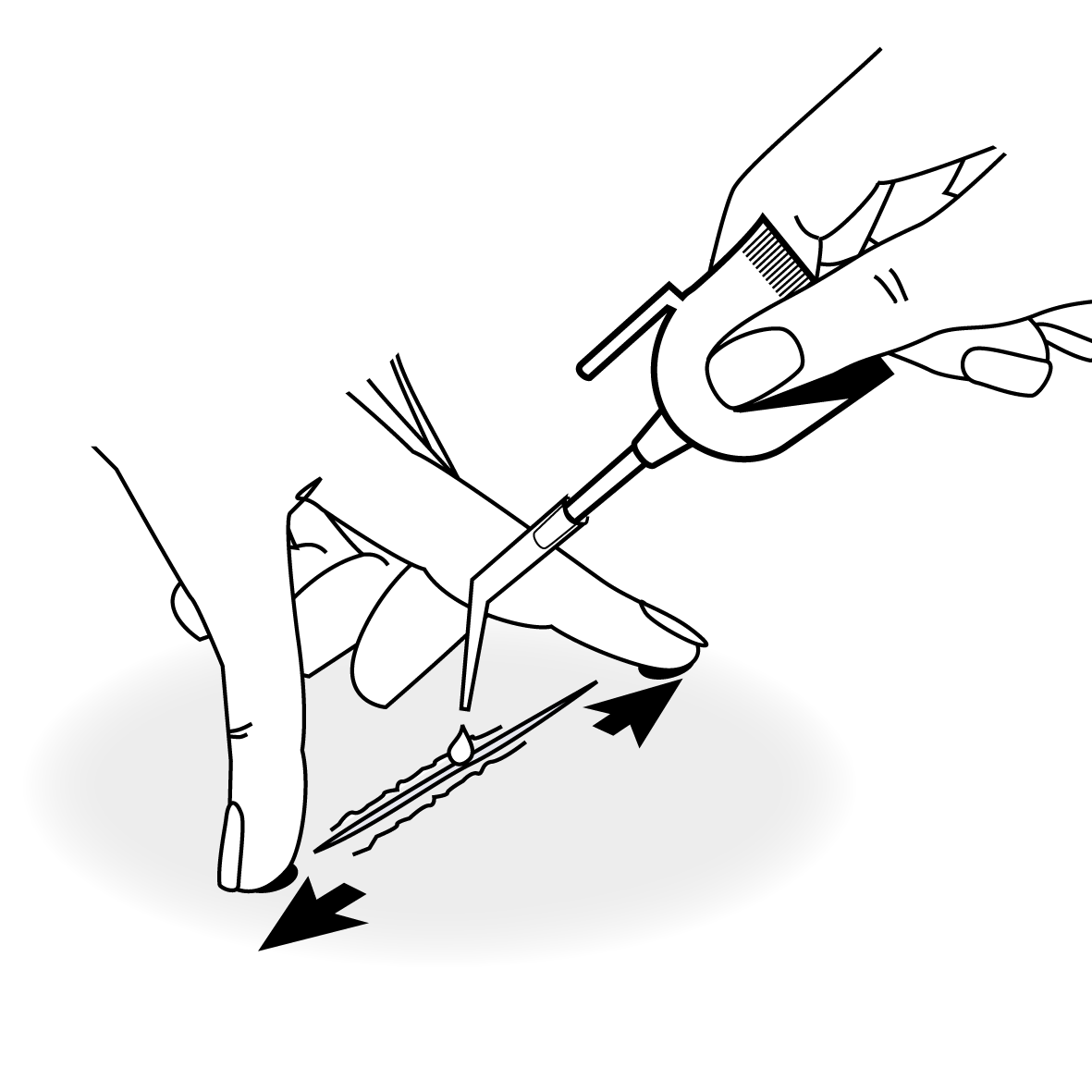 Wundkleber: Die beste Erfindung seit es Nadel und Faden gibt / Modernes ...