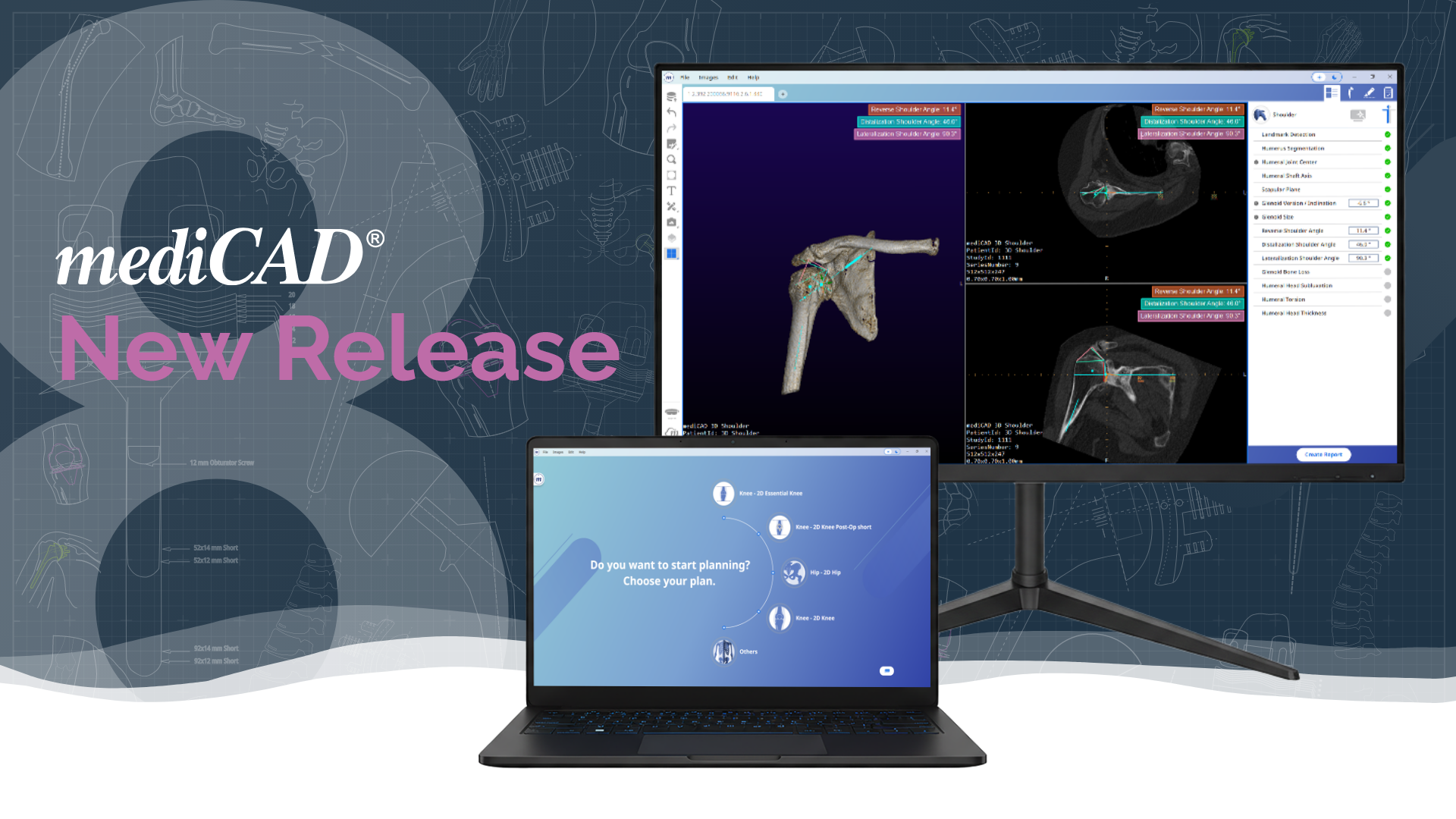 New software release mediCAD® 8, mediCAD Hectec GmbH, Story - PresseBox
